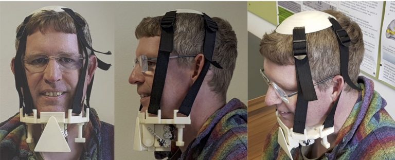 3D-printable ultrasound probe stabilizer for speech research | Maps of ...